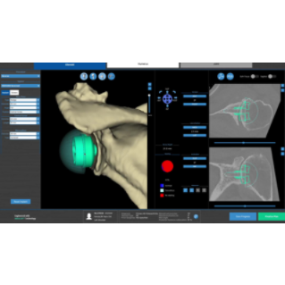 Shoulder iD™ | Stryker